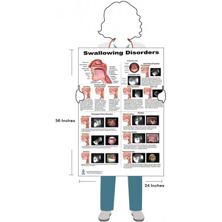 Swallowing and Swallowing Disorder Large Poster Set