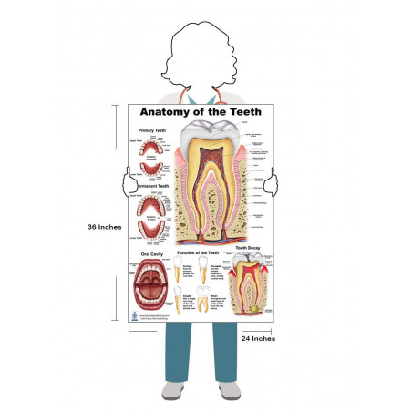 Anatomy of The Teeth, Tooth Implant and Repair Poster LP 24x36 inch, 2 ...