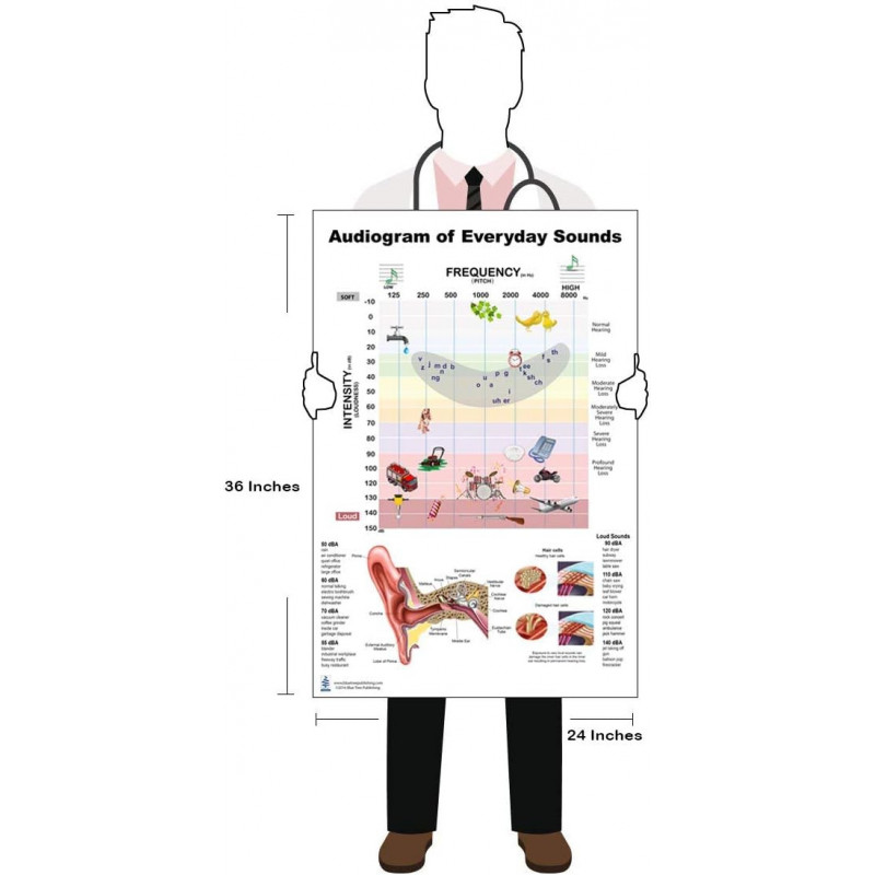 Audiogram of Everyday Sound Large Poster, Speech Banana, Frequency ...