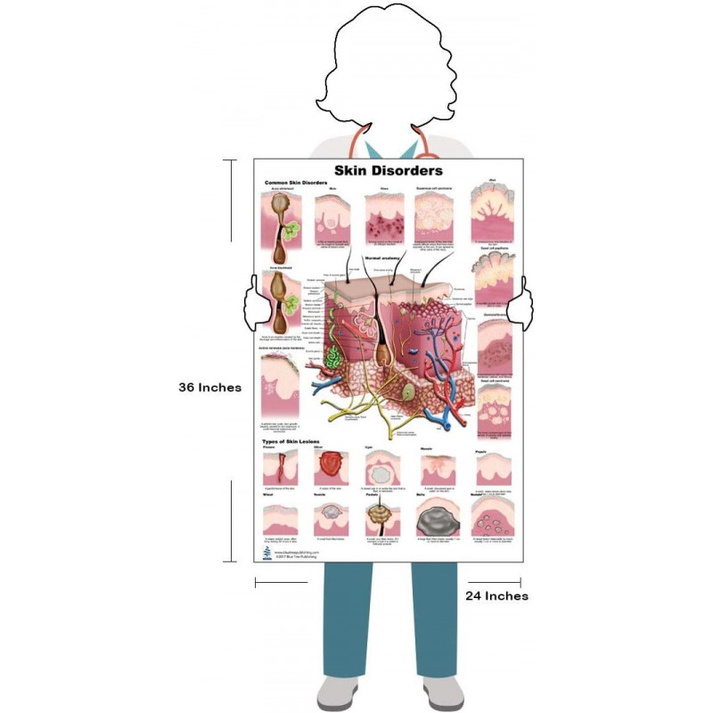 Skin Disorders Large Poster