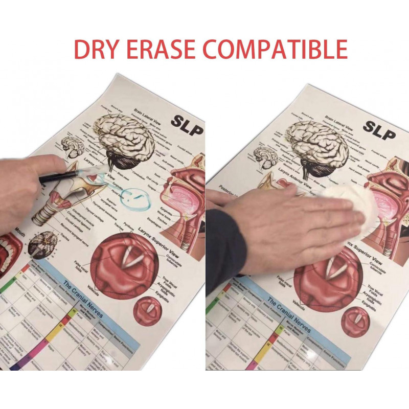 Audiogram of Everyday Sound Regular Poster, Speech Banana, Frequency ...