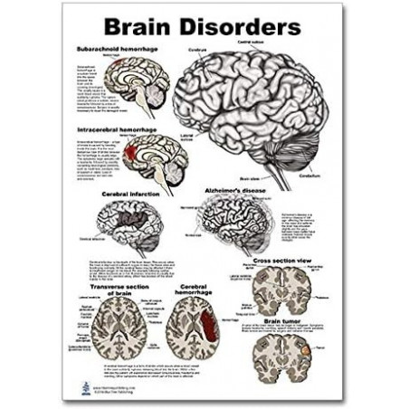Brain Disorders Regular Poster