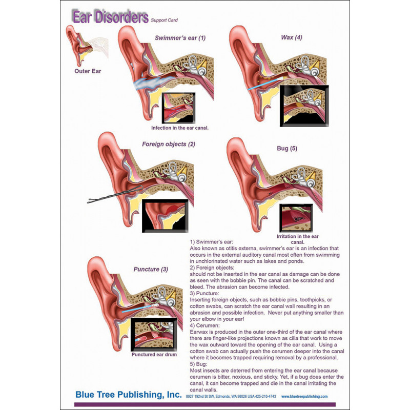 Ear Disorders Anatomical Chart Set