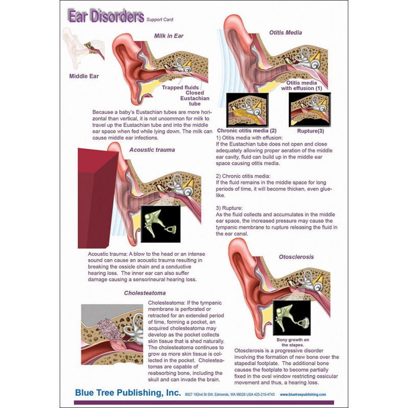 Ear Disorders Anatomical Chart Set