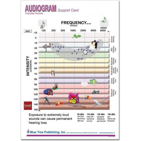 Audiogram of Everyday Sound Anatomical Chart, Speech Banana, Frequency ...