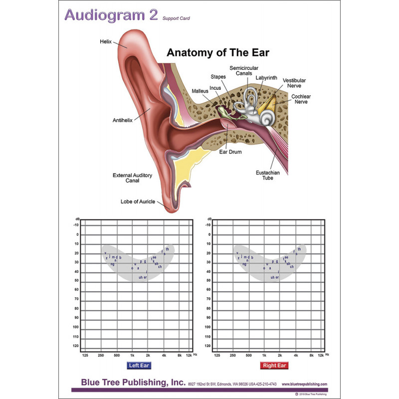 Audiogram 2 Anatomical Chart, Speech Banana, Frequency, Pitch and Ear ...