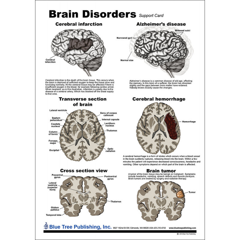 Brain Disorders Anatomical Chart