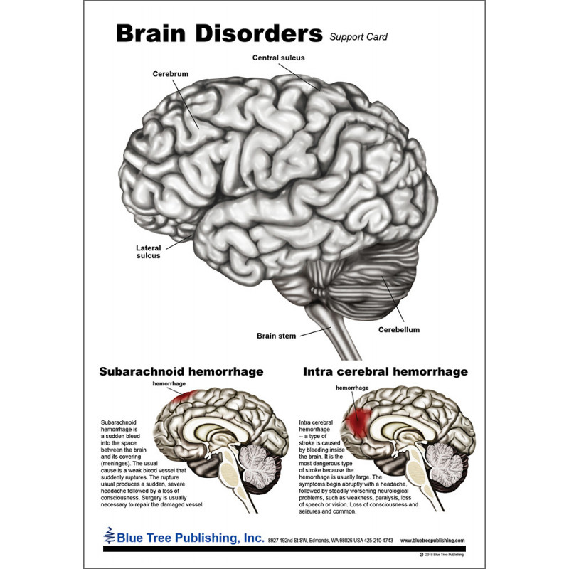 Brain Disorders Anatomical Chart