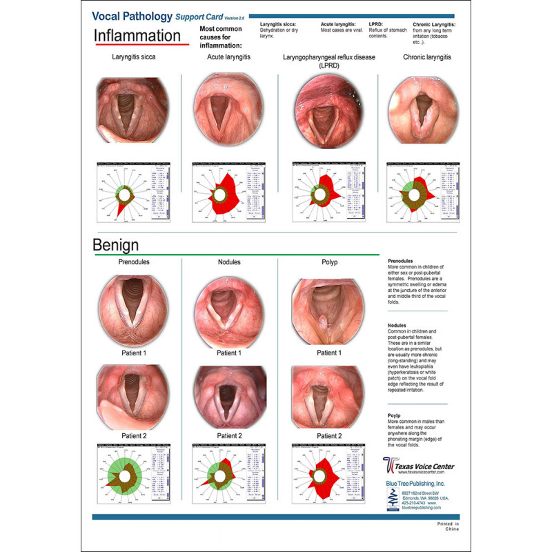 Vocal Pathology 1 Chart, Malignant, Neurological, Inflammation, Benign