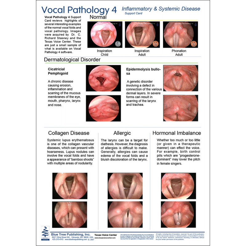 Vocal Pathology 4 Chart Set, Inflammatory, Systemic Disease