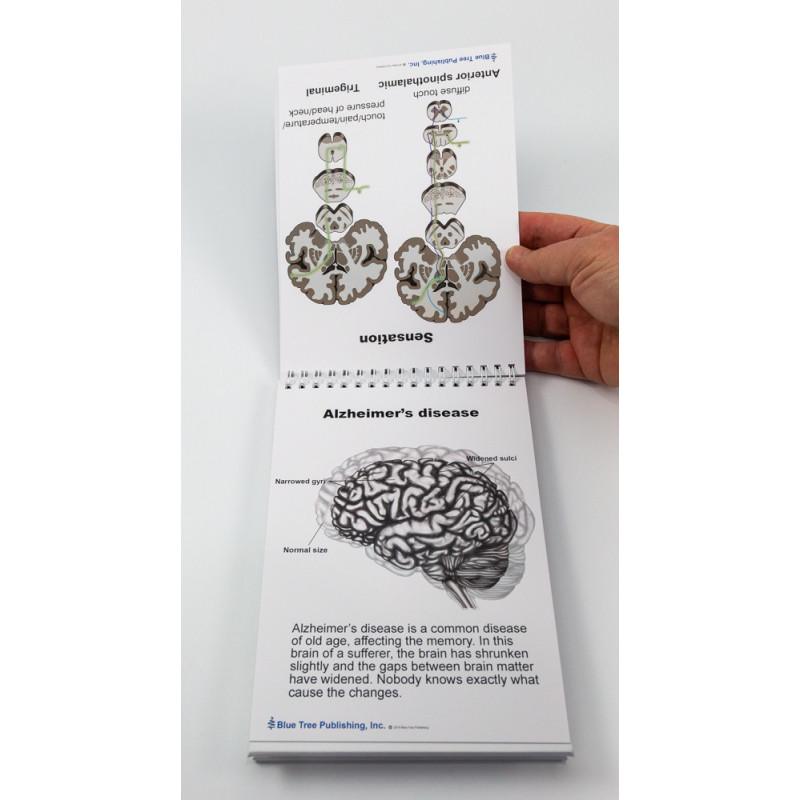 Brain Anatomy Flip Chart
