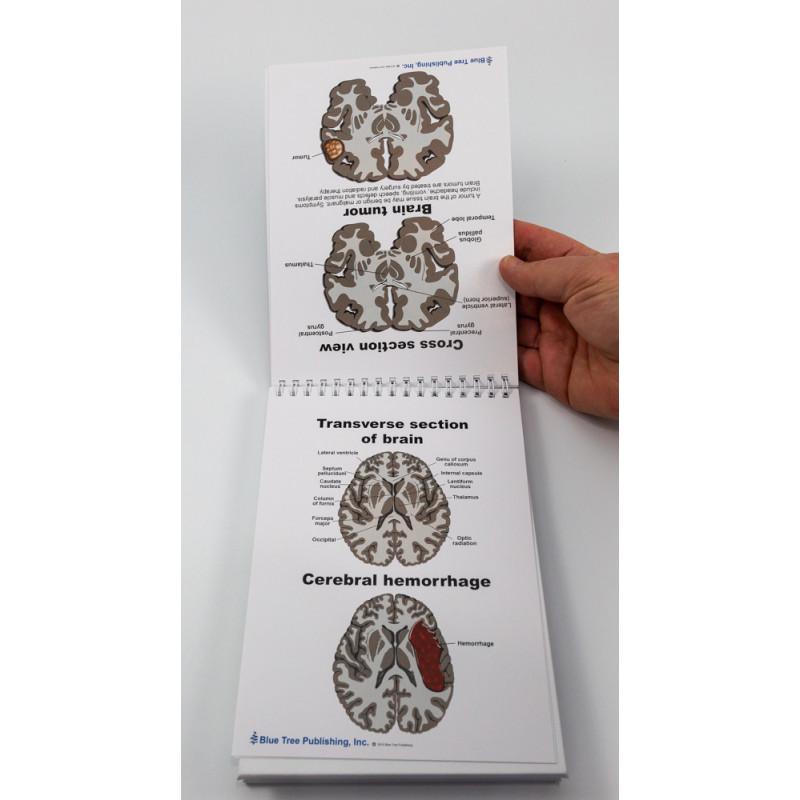 Brain Anatomy Flip Chart