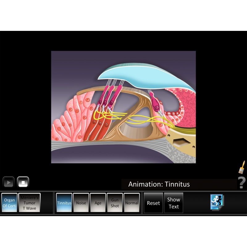 Inner Ear Disorders App