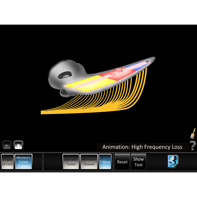 Inner Ear Disorders App