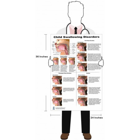 Child Swallowing Disorders Large Poster Dysphagia Endoscopic View-oral ...
