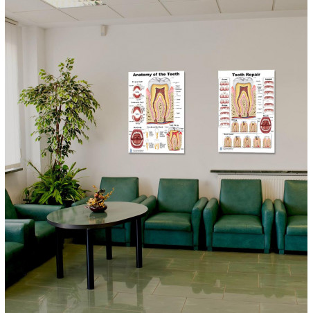 Anatomy of The Teeth, Tooth Implant and Repair Poster LP 24x36 inch, 2 ...