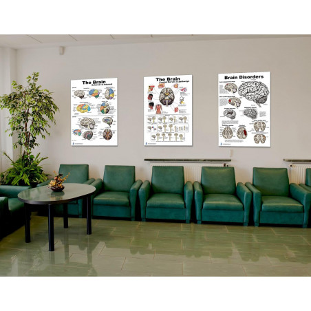 Brain, Cranial Nerves, Pathways and Brain Disorders 3 Poster set 24 ...