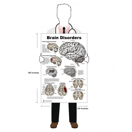 Brain, Cranial Nerves, Pathways and Brain Disorders 3 Poster set 24 ...