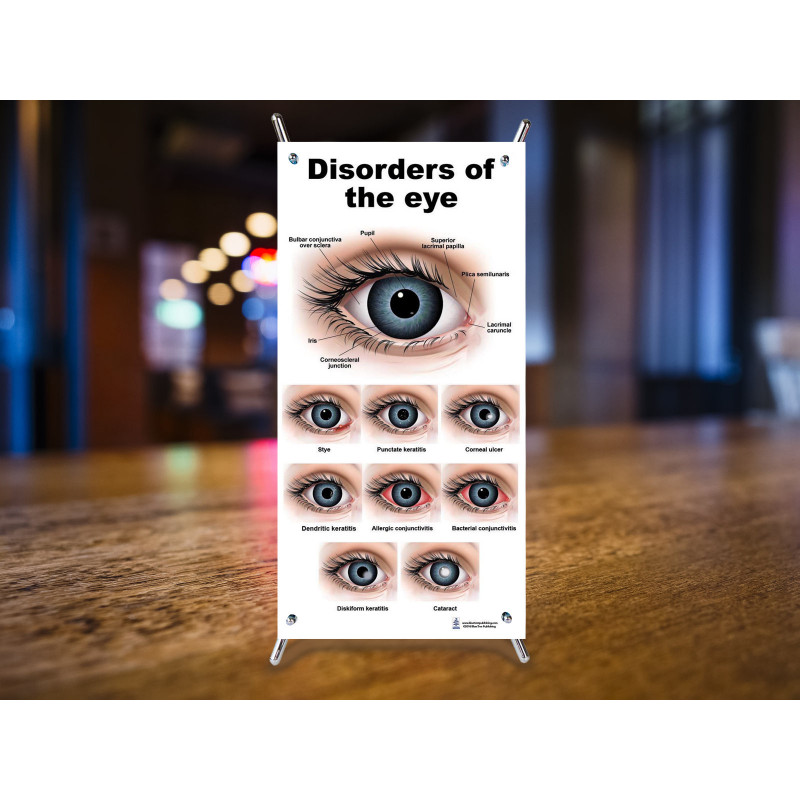 Eye Anatomy and Disorders of The Eye 2 Set Small Poster